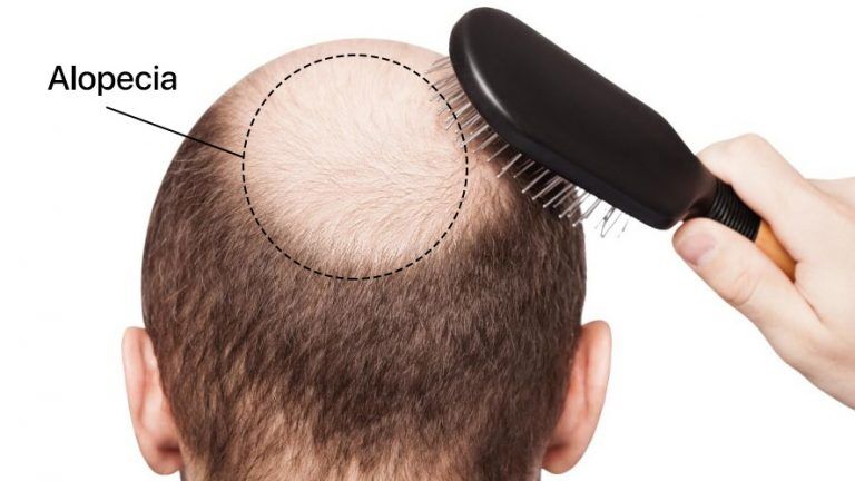 Los mejores peinados para hombres mayores con cabello ralo