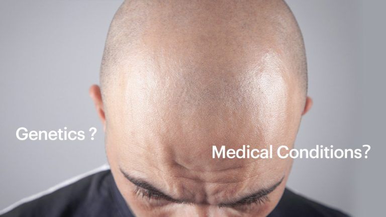 50 mejores cortes de pelo y peinados para la corona calva en 2024