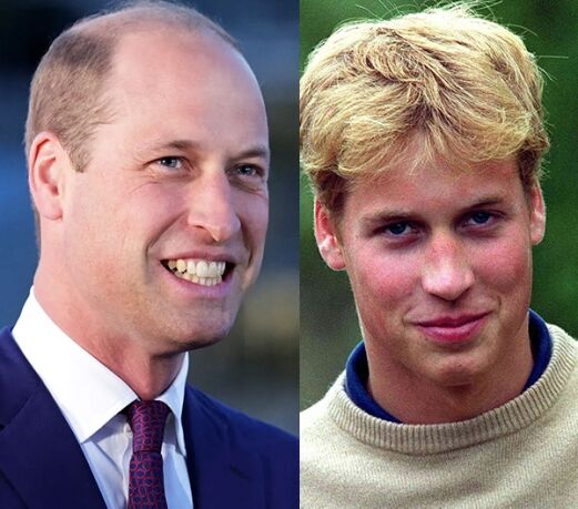 Top 50 Famous Bald Actors and Their Past Looks