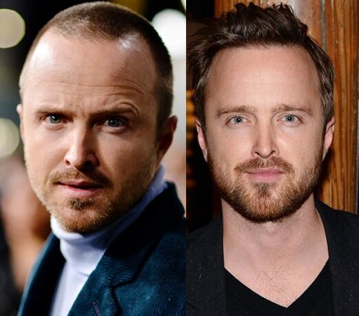 Top 50 Famous Bald Actors and Their Past Looks
