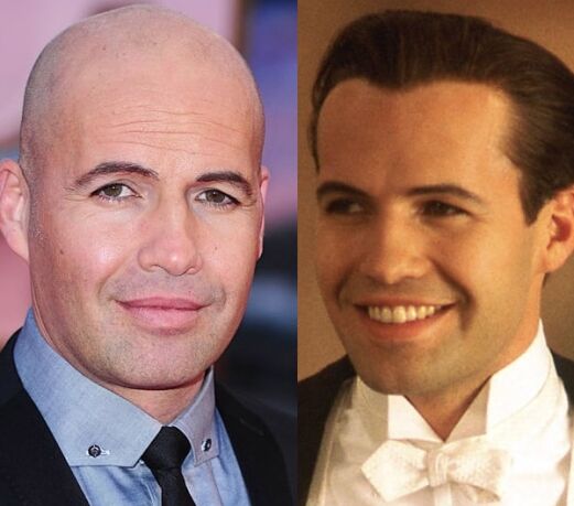 Top 50 Famous Bald Actors and Their Past Looks