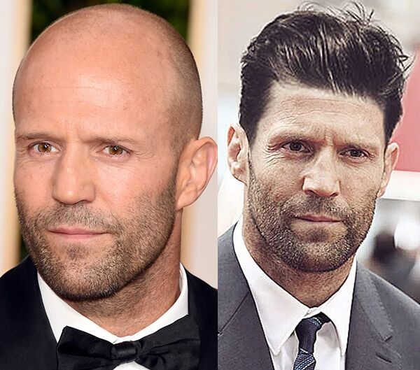 Top 50 Famous Bald Actors and Their Past Looks