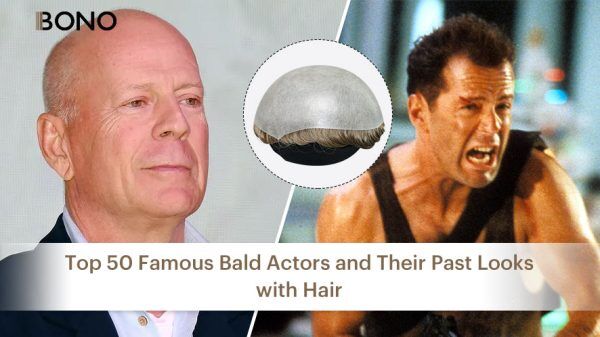 Top 50 Famous Bald Actors and Their Past Looks